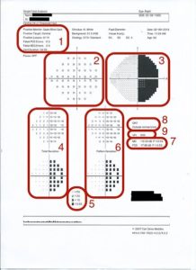Virtual Reality Visual Field | Moran Eye Associates